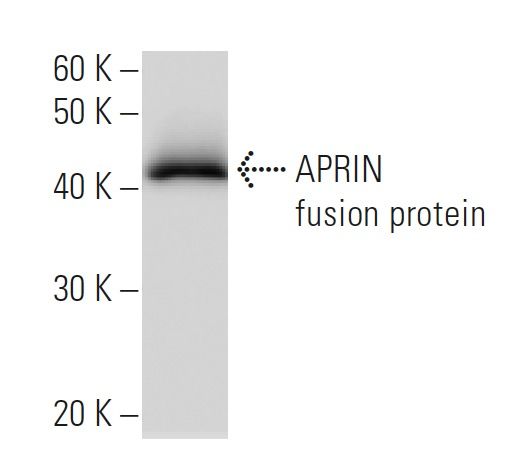 APRIN Antibody (2030D32a) | SCBT - Santa Cruz Biotechnology