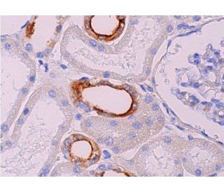 Aquaporin 2/AQP2 Antibody (E-2) | SCBT - Santa Cruz Biotechnology