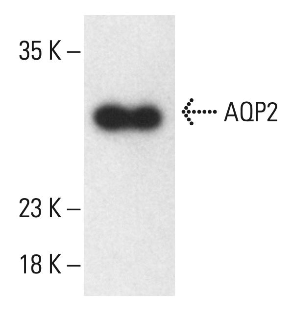 Aquaporin 2/AQP2 Antibody (E13-21) | SCBT - Santa Cruz Biotechnology