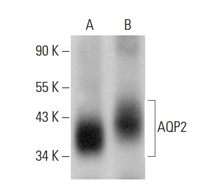 Anti-Aquaporin 2/AQP2 Antibody (G-3) | SCBT - Santa Cruz Biotechnology