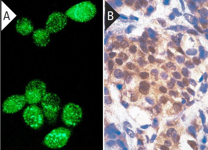 AR/Androgen Receptor Antibody (441) | SCBT - Santa Cruz Biotechnology