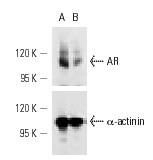 Anti-AR/Androgen Receptor Antibody (441) | SCBT - Santa Cruz Biotechnology