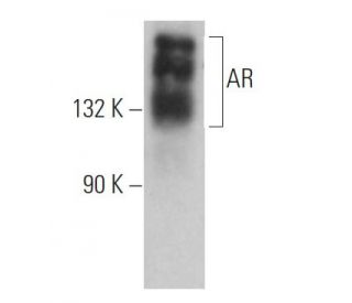 Anti-AR/Androgen Receptor Antibody (441) | SCBT - Santa Cruz Biotechnology