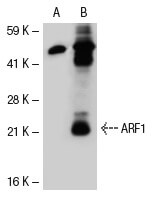 Anti-ARF1 Antibody (ARFS 5F2/2) | SCBT - Santa Cruz Biotechnology