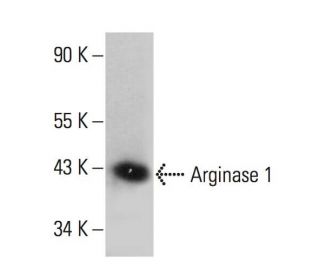 Anti-liver Arginase 1/ARG1 Antibody (A-2) | SCBT - Santa Cruz Biotechnology