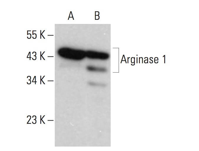 Anti-liver Arginase 1/ARG1 Antibody (C-2) | SCBT - Santa Cruz Biotechnology