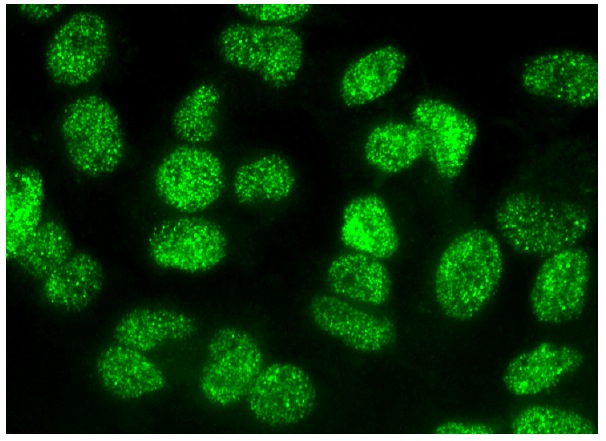 Anti-ARID2 Antibody (E-3) | SCBT - Santa Cruz Biotechnology