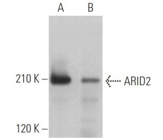 Anti-ARID2 Antibody (E-3) | SCBT - Santa Cruz Biotechnology