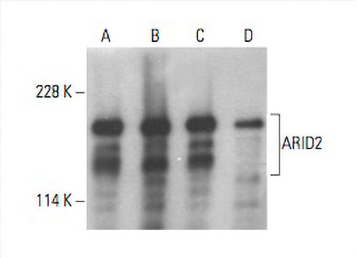 Anti-ARID2 Antibody (E-3) | SCBT - Santa Cruz Biotechnology