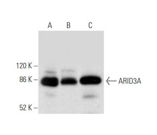 ARID3A CRISPR/Cas9 KO Plasmid (h) | SCBT - Santa Cruz Biotechnology