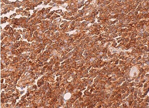 Arp2 Antibody (E-12) | SCBT - Santa Cruz Biotechnology