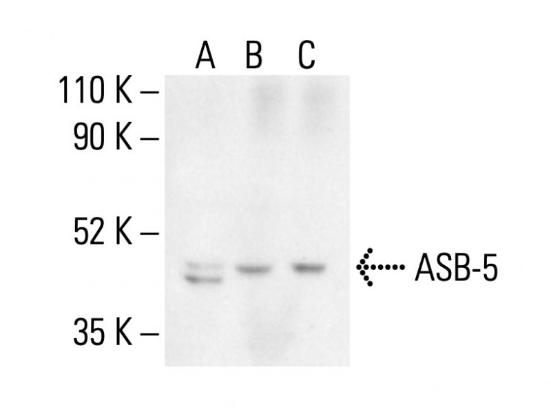ASB-5 Antibody (E-8) | SCBT - Santa Cruz Biotechnology