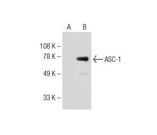 Anti-ASC-1 Antibody (F-7) | SCBT - Santa Cruz Biotechnology