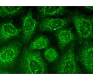 ASC-1 Antibody (F-8) | SCBT - Santa Cruz Biotechnology