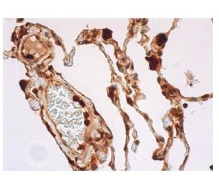 ASC Antibody (B-3) - Immunohistochemistry - Image 352924
