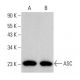 Anti-ASC/TMS1/PYCARD Antibody (B-3) | SCBT - Santa Cruz Biotechnology
