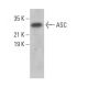 Anti-ASC/TMS1/PYCARD Antibody (B-3) | SCBT - Santa Cruz Biotechnology