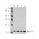 Anti-ASC/TMS1/PYCARD Antibody (B-3) | SCBT - Santa Cruz Biotechnology