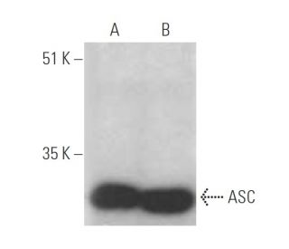 Anti-ASC/TMS1/PYCARD Antibody (B-3) | SCBT - Santa Cruz Biotechnology