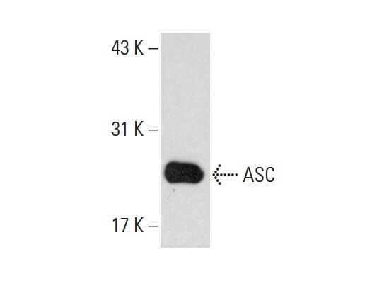 Anti-ASC/TMS1/PYCARD Antibody (F-9) | SCBT - Santa Cruz Biotechnology