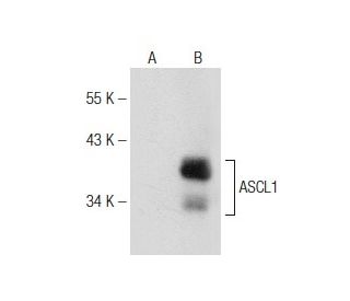 Anti-ASCL1 Antibody (D-7) | SCBT - Santa Cruz Biotechnology