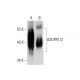 Asialoglycoprotein Receptor 1/2/ASGR1/ASGR2 Antibody (E-1) | SCBT ...