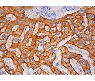 ASGPR2/Asialoglycoprotein Receptor 2/ASGR2 Antibody (B-4) | SCBT ...