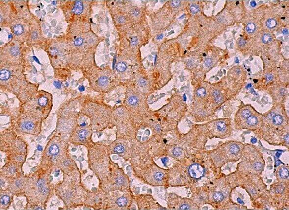 Anti-ASGPR2/Asialoglycoprotein Receptor 2/ASGR2 Antibody (B-4) | SCBT ...