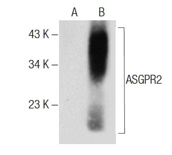 Anti-ASGPR2/Asialoglycoprotein Receptor 2/ASGR2 Antibody (B-4) | SCBT ...
