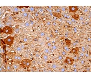 ASGPR2/Asialoglycoprotein Receptor 2/ASGR2 Antibody (C-4) | SCBT ...