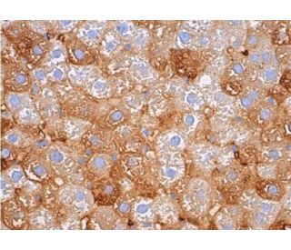 ASGPR2/Asialoglycoprotein Receptor 2/ASGR2 Antibody (C-4) | SCBT ...