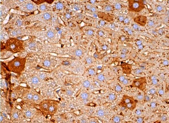 ASGPR2/Asialoglycoprotein Receptor 2/ASGR2 Antibody (C-4) | SCBT ...