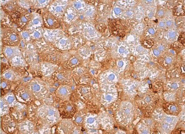 ASGPR2/Asialoglycoprotein Receptor 2/ASGR2 Antibody (C-4) | SCBT ...