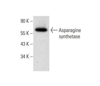 Asparagine synthetase Antibody (G-10) - Western Blotting - Image 305717