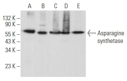Asparagine synthetase Antibody (G-10) | SCBT - Santa Cruz Biotechnology