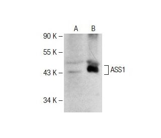 Anti-ASS1 Antibody (E-12) | SCBT - Santa Cruz Biotechnology
