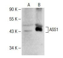 Anti-ASS1 Antibody (E-12) | SCBT - Santa Cruz Biotechnology