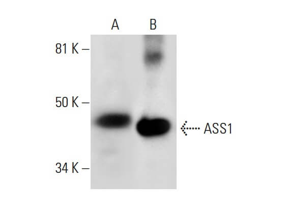 Anti-ASS1 Antibody (E-12) | SCBT - Santa Cruz Biotechnology