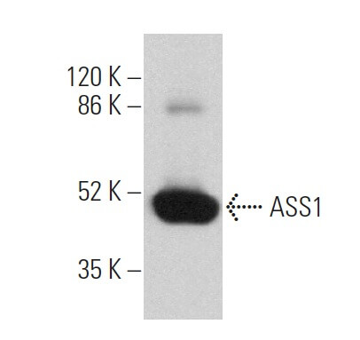 Anti-ASS1 Antibody (E-12) | SCBT - Santa Cruz Biotechnology