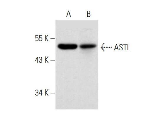 ASTL Antibody (D-8) | SCBT - Santa Cruz Biotechnology