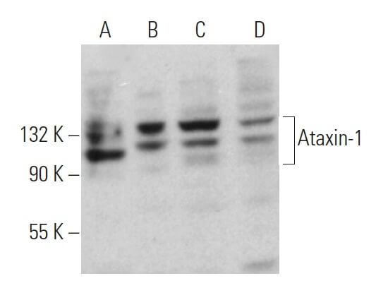 Anti-Ataxin-1 Antibody (E-4) | SCBT - Santa Cruz Biotechnology