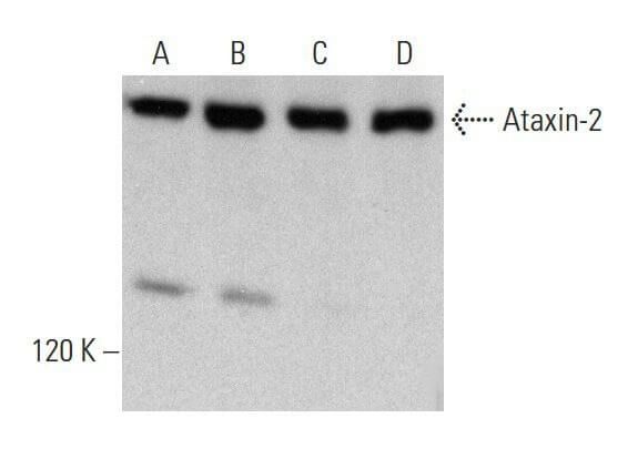 Ataxin-2 Antibody (A-6) | SCBT - Santa Cruz Biotechnology