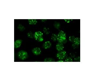 Anti-ATF-1/ATF1 Antibody (25C10G) | SCBT - Santa Cruz Biotechnology