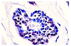 Anti-ATF-1/ATF1 Antibody (25C10G) | SCBT - Santa Cruz Biotechnology
