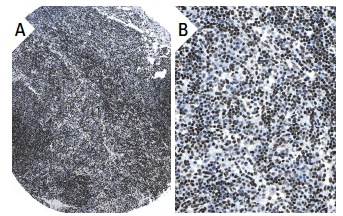 Anti-ATF-1/ATF1 Antibody (25C10G) | SCBT - Santa Cruz Biotechnology