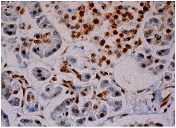 Anti-ATF-1/ATF1 Antibody (25C10G) | SCBT - Santa Cruz Biotechnology