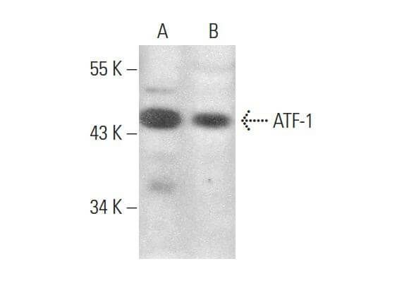 ATF-1/ATF1 Antibody (25C10G) | SCBT - Santa Cruz Biotechnology
