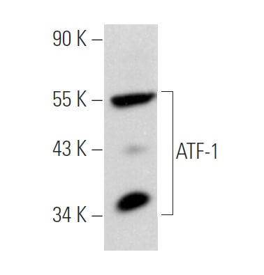 Anti-ATF-1/ATF1 Antibody (25C10G) | SCBT - Santa Cruz Biotechnology