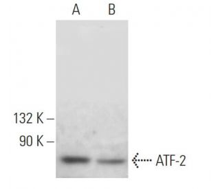 Anti-ATF-2 Antibody (F2BR-1) | SCBT - Santa Cruz Biotechnology