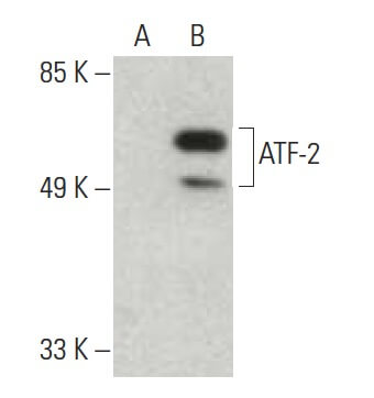 Anti-ATF-2 Antibody (F2BR-1) | SCBT - Santa Cruz Biotechnology
